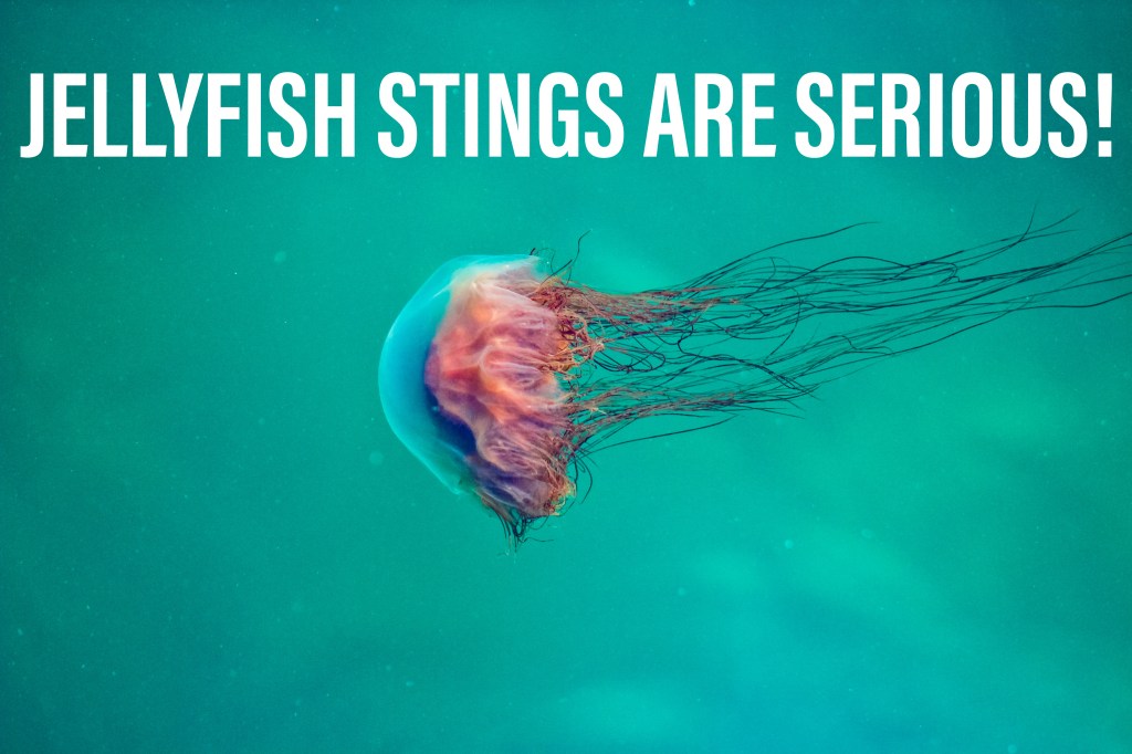 Irukandji Syndrome – The Box Jellyfish (It’s Serious!) – LOE+W